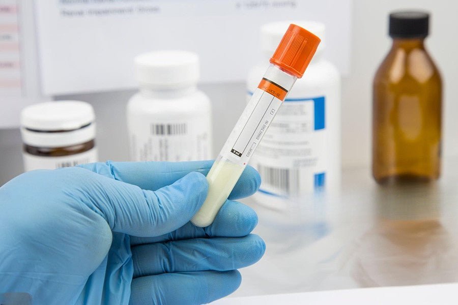 ¿Puede el líquido preseminal ser blanco y qué significa? | Conceive Plus®